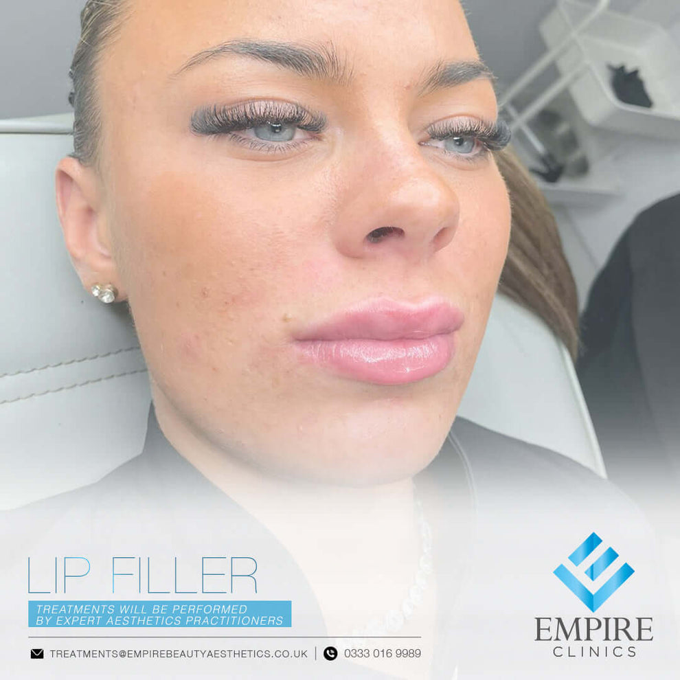 Lip Filler Injections in Liverpool – Empire Clinics